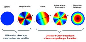 Adaptation de Lentilles de Contact - Ophta77