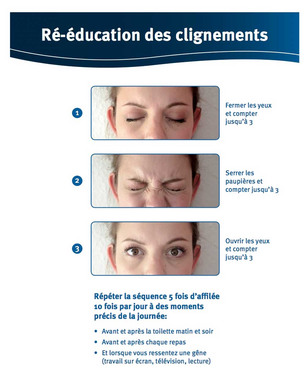 Traitement de l'Oeil Sec au centre de Barbizon - Ophta77